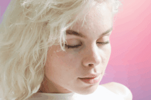 What Are Sebum Plugs? A Guide to Blocked Sebaceous Glands – Acne Club