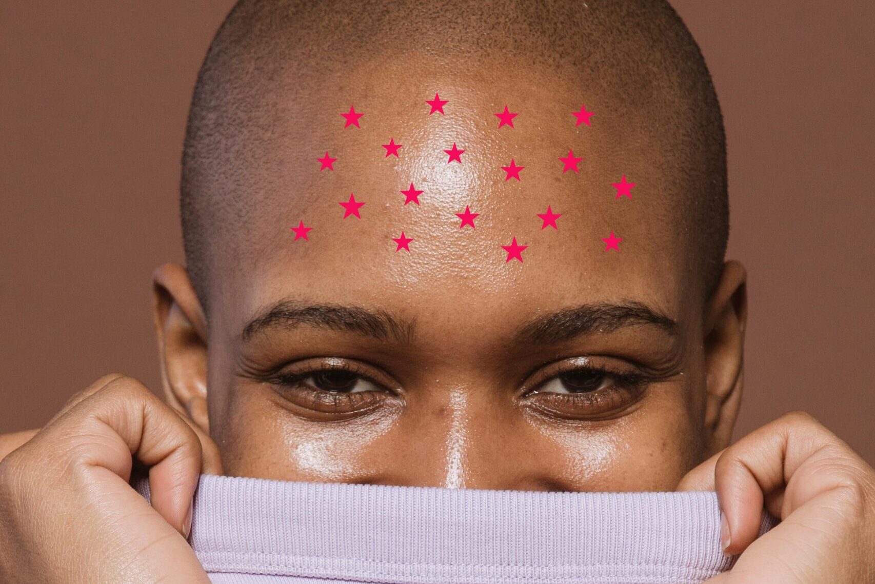 Cystic Acne: What It Is, How to Treat It, and How to Prevent It – Acne Club