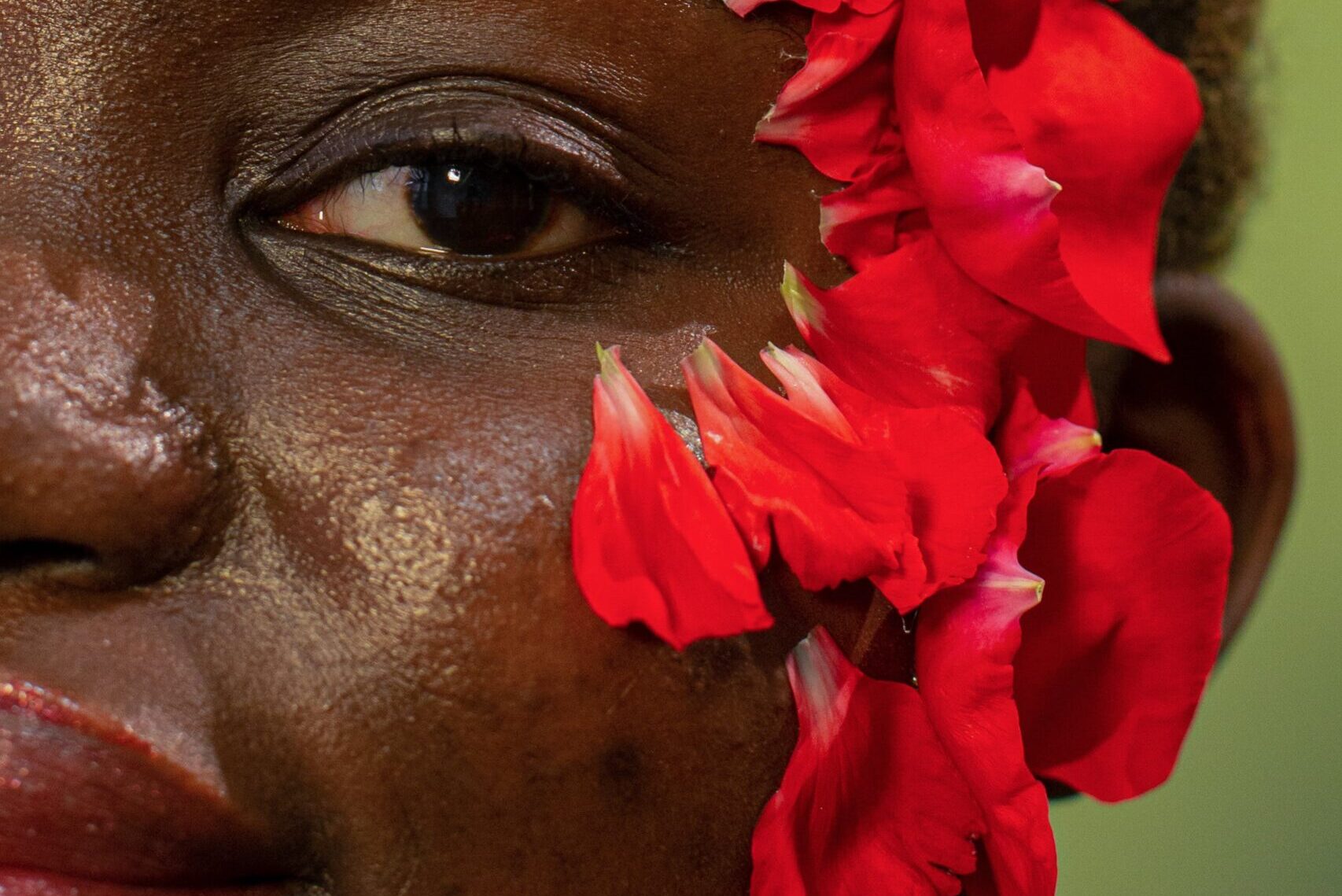 What Are Sebum Plugs? A Guide to Blocked Sebaceous Glands – Acne Club